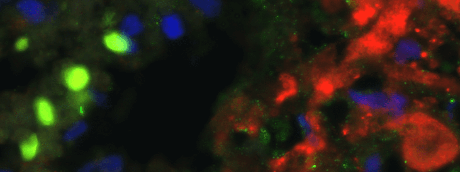 Explainer: What are prions? – Van Andel Institute