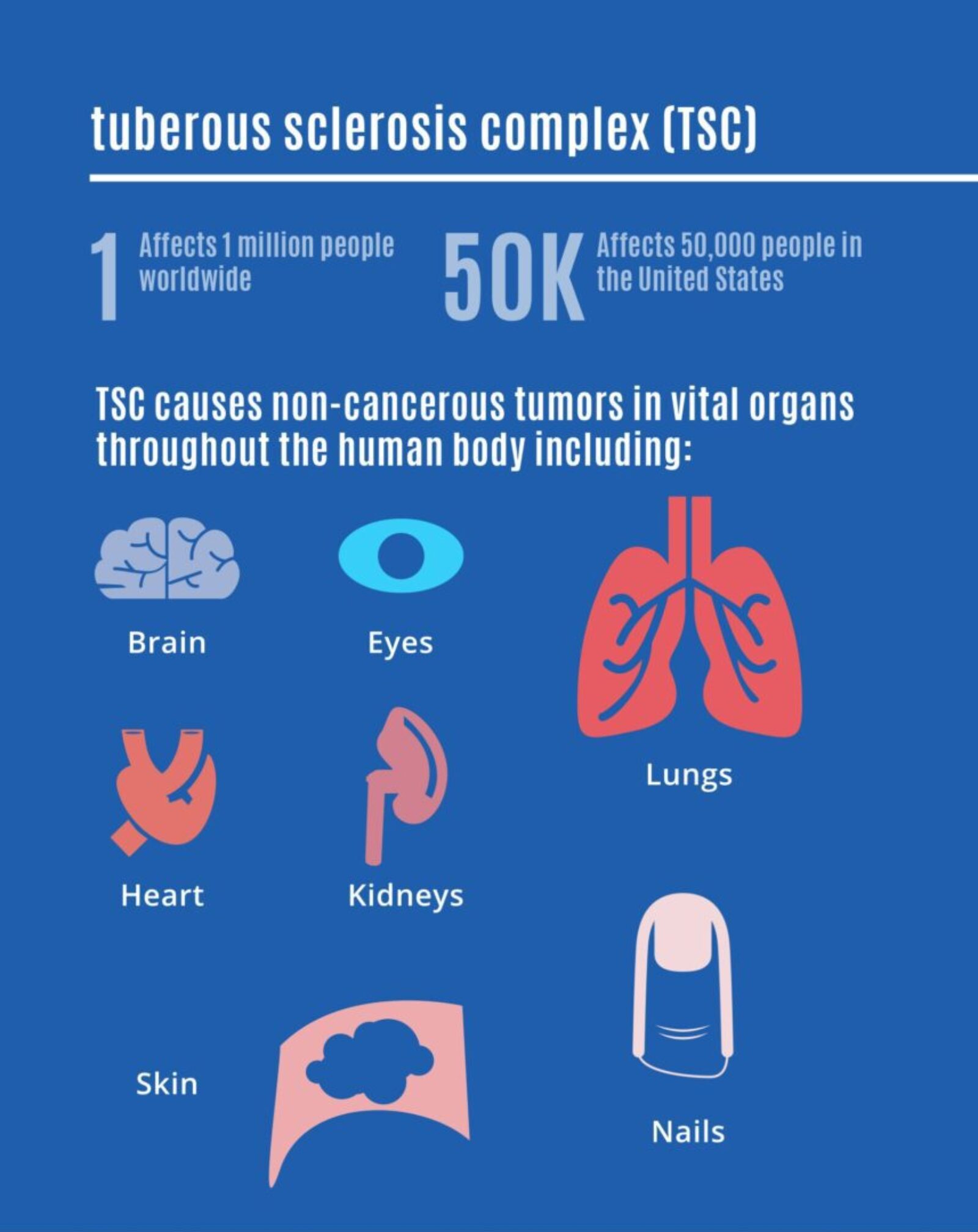 Today is TSC Global Awareness Day – Van Andel Institute