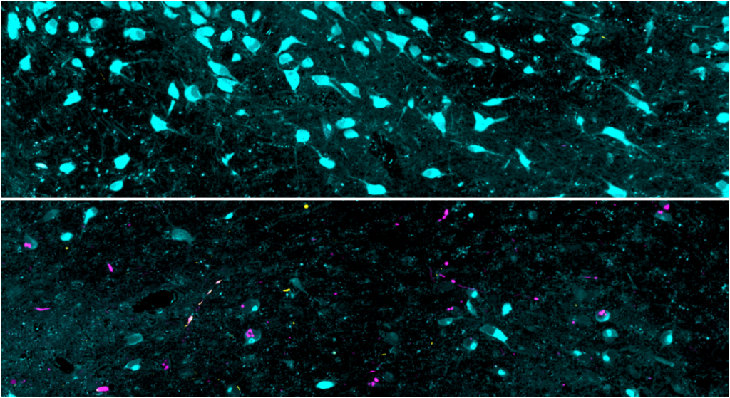 Explainer: What is alpha-synuclein? – Van Andel Institute